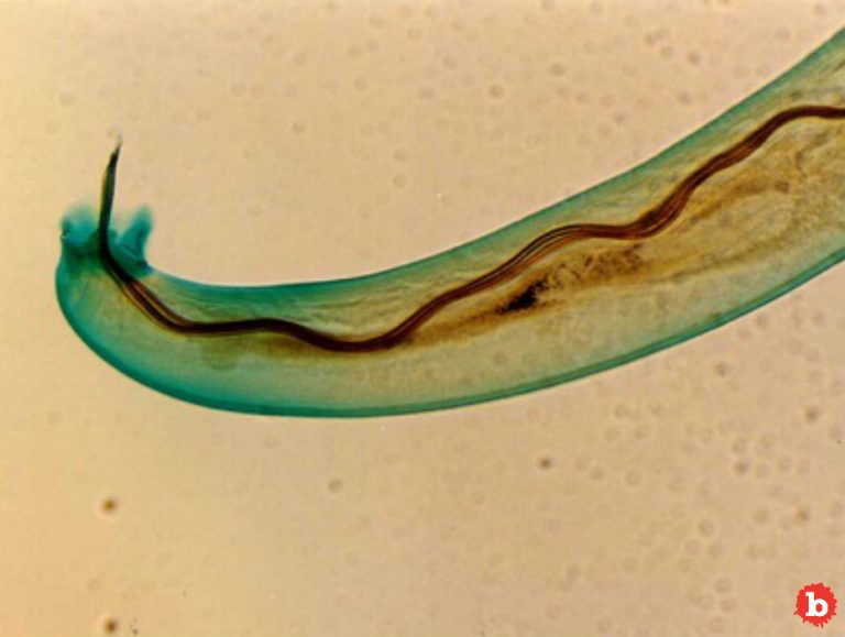 Three More Cases of Brain Burrowing Parasitic Worms in Hawaii